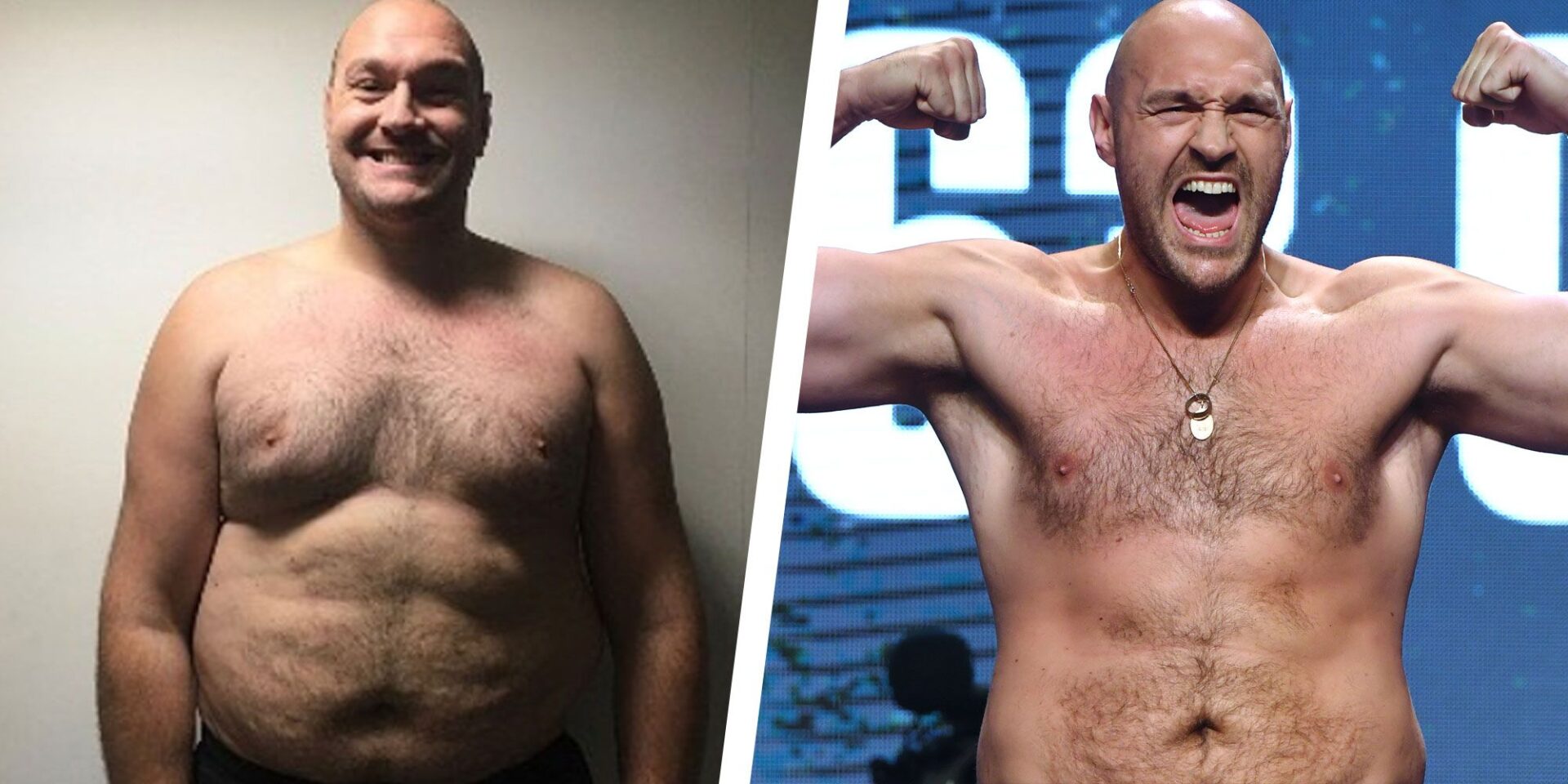 Tyson Fury: Early Life, Mental Health & Comeback - Players Bio