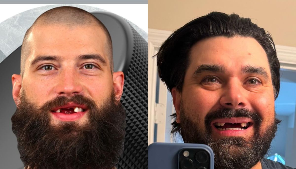 Joey Cold Cuts Reveals The Genetic Condition Behind His Missing Front ...