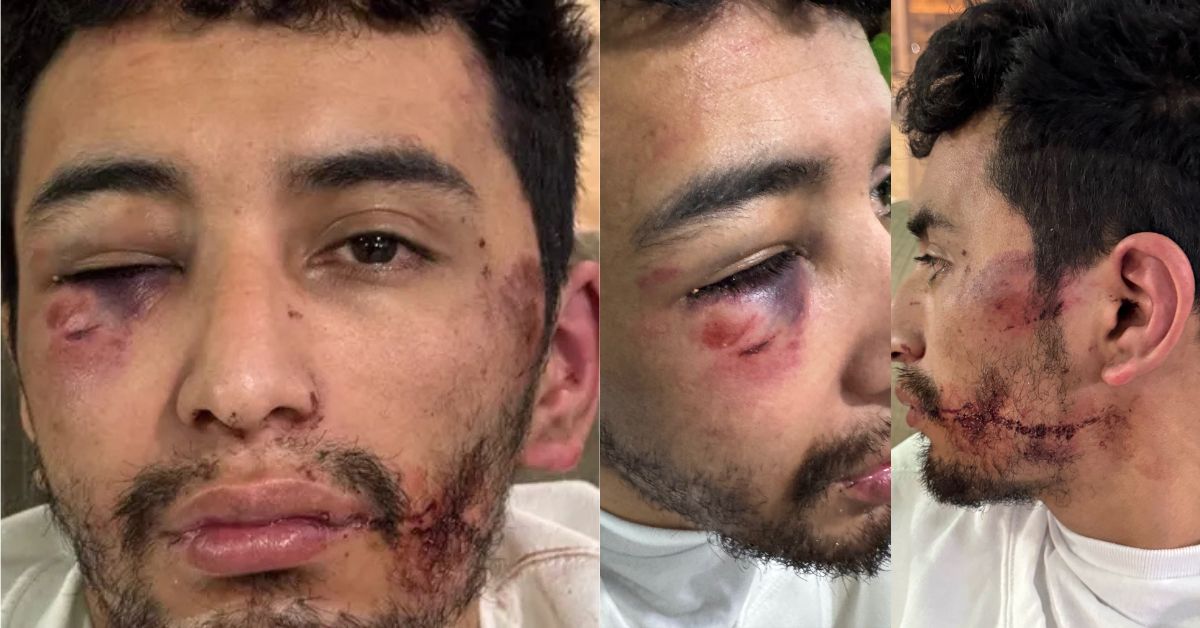 Fake $40K GoFundMe Raised Over ICE Beating of ‘Juan Carlos’ Near Hope ...