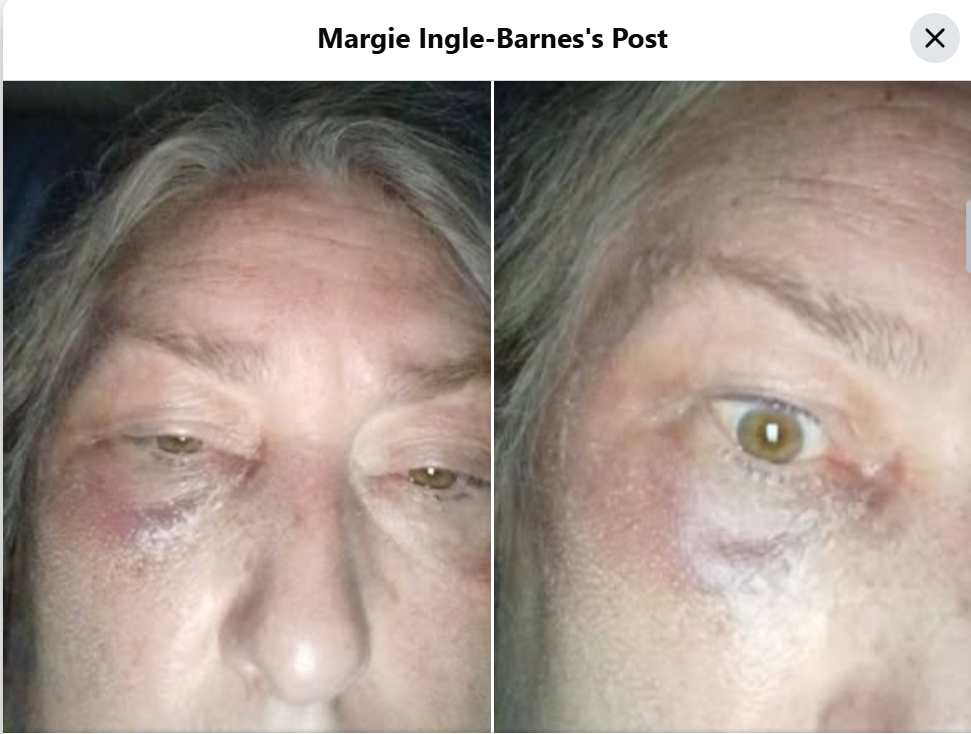 Indiana Woman Loses Herself After Choosing Love, Funding Basketball ...